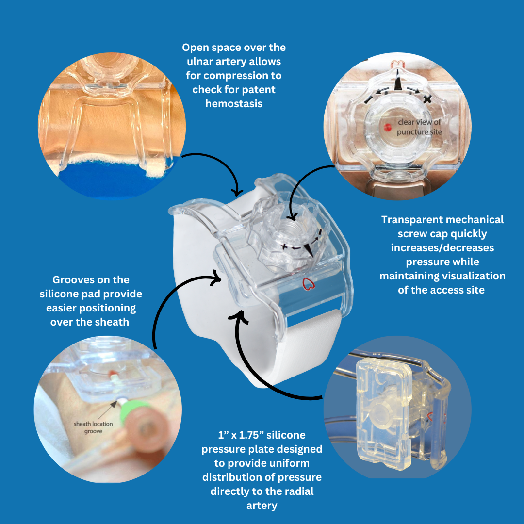 Radial Optimal Compression